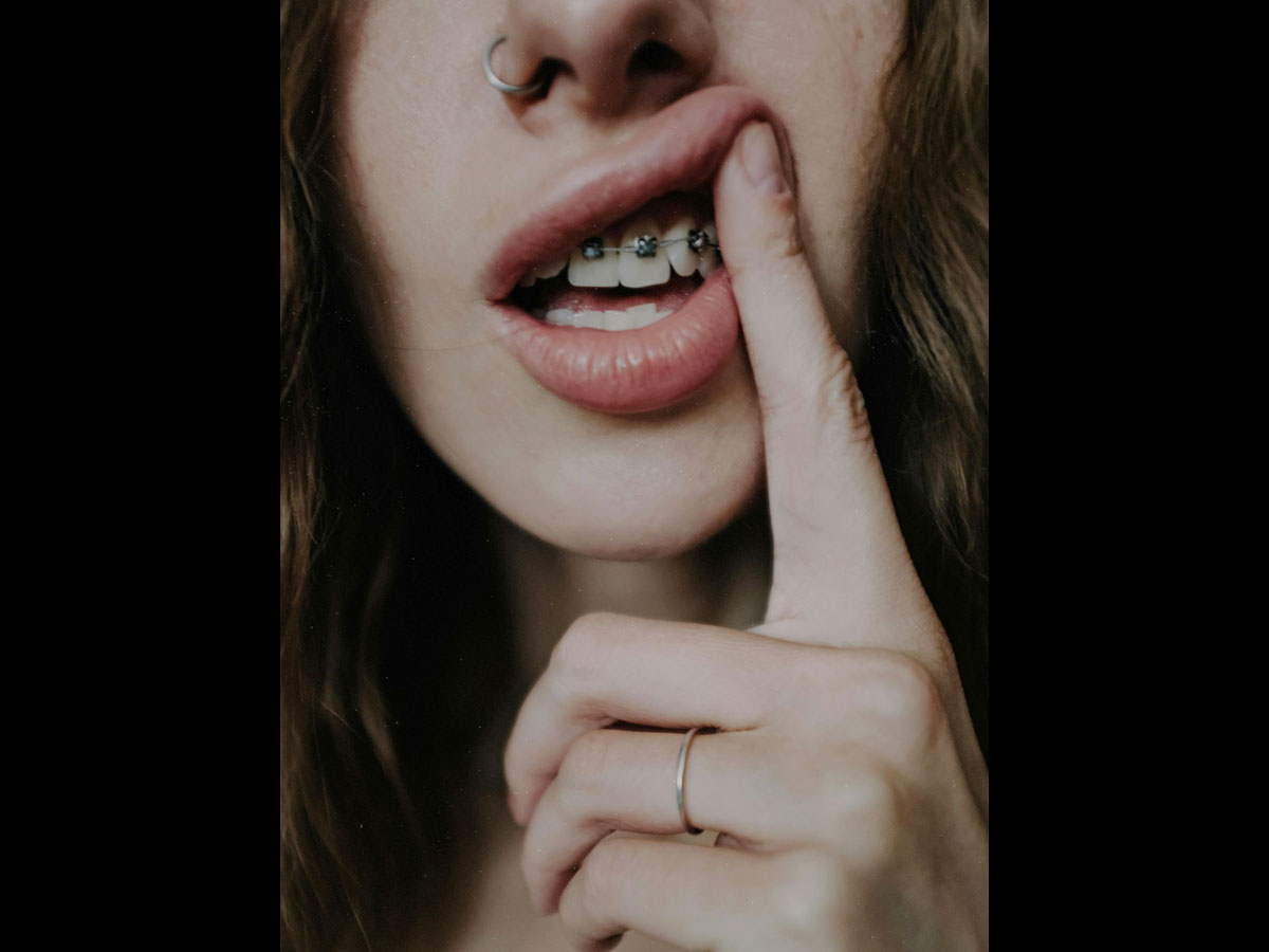 WATCH: Expert Warns Versus DIY Braces | OneNews.PH