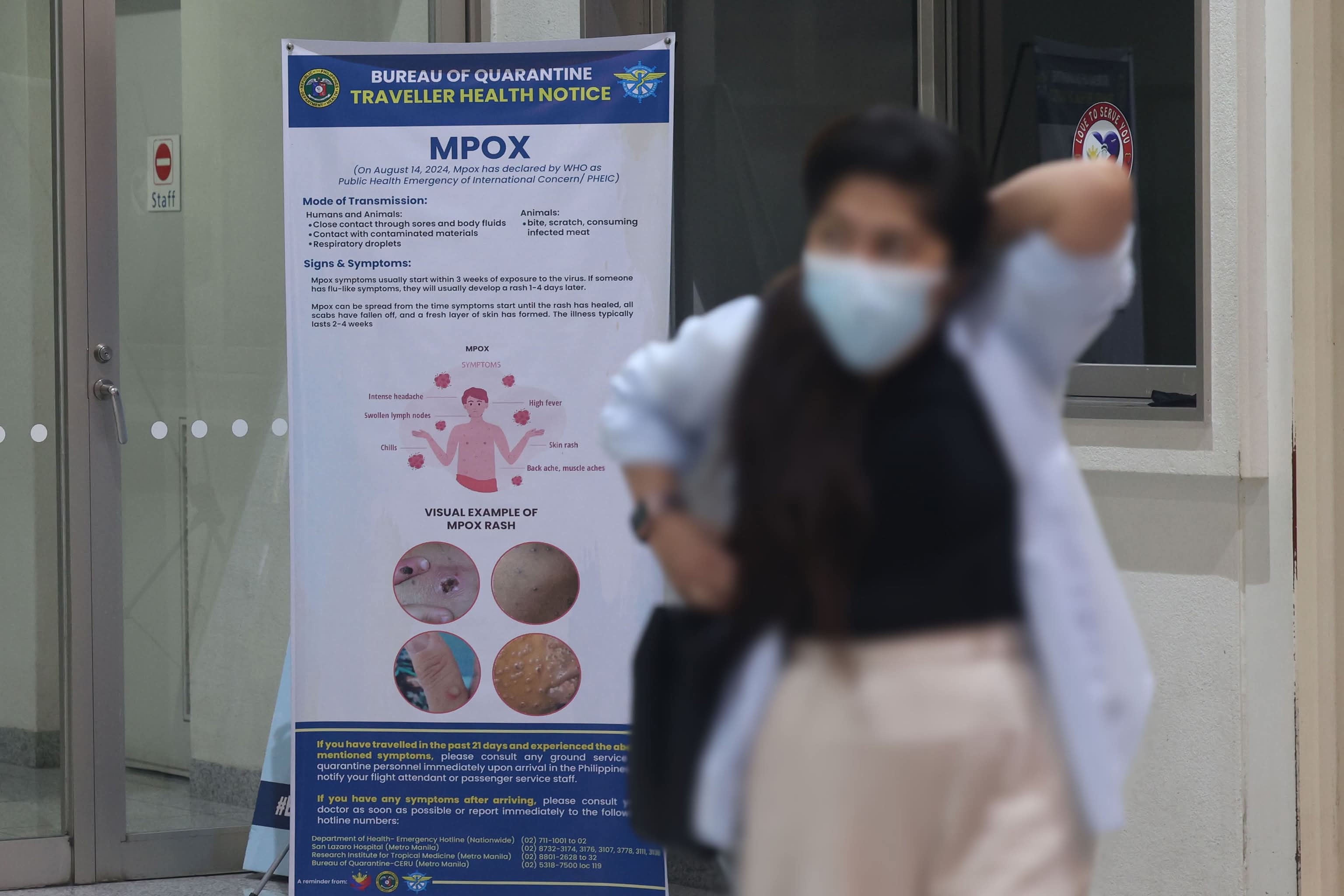 Amid Rumors, DOH Says No Mpox Lockdown | OneNews.PH